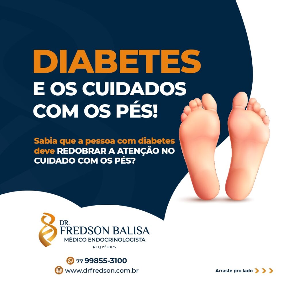 DIABETES E OS CUIDADOS COM OS PES! – Dr. Fredson